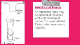 Genu varum orthotic management | PDF