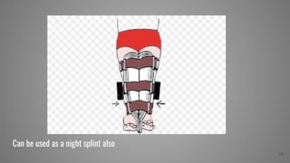 Genu varum orthotic management | PDF