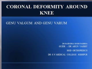 Genu varum semi | PPT