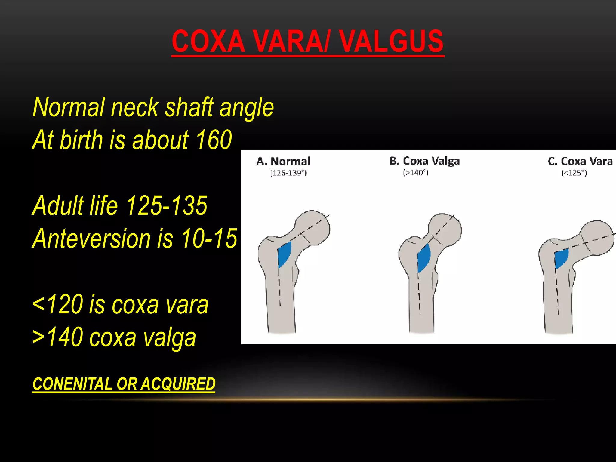 Genu varum valgus ,coxa varum | PPTX