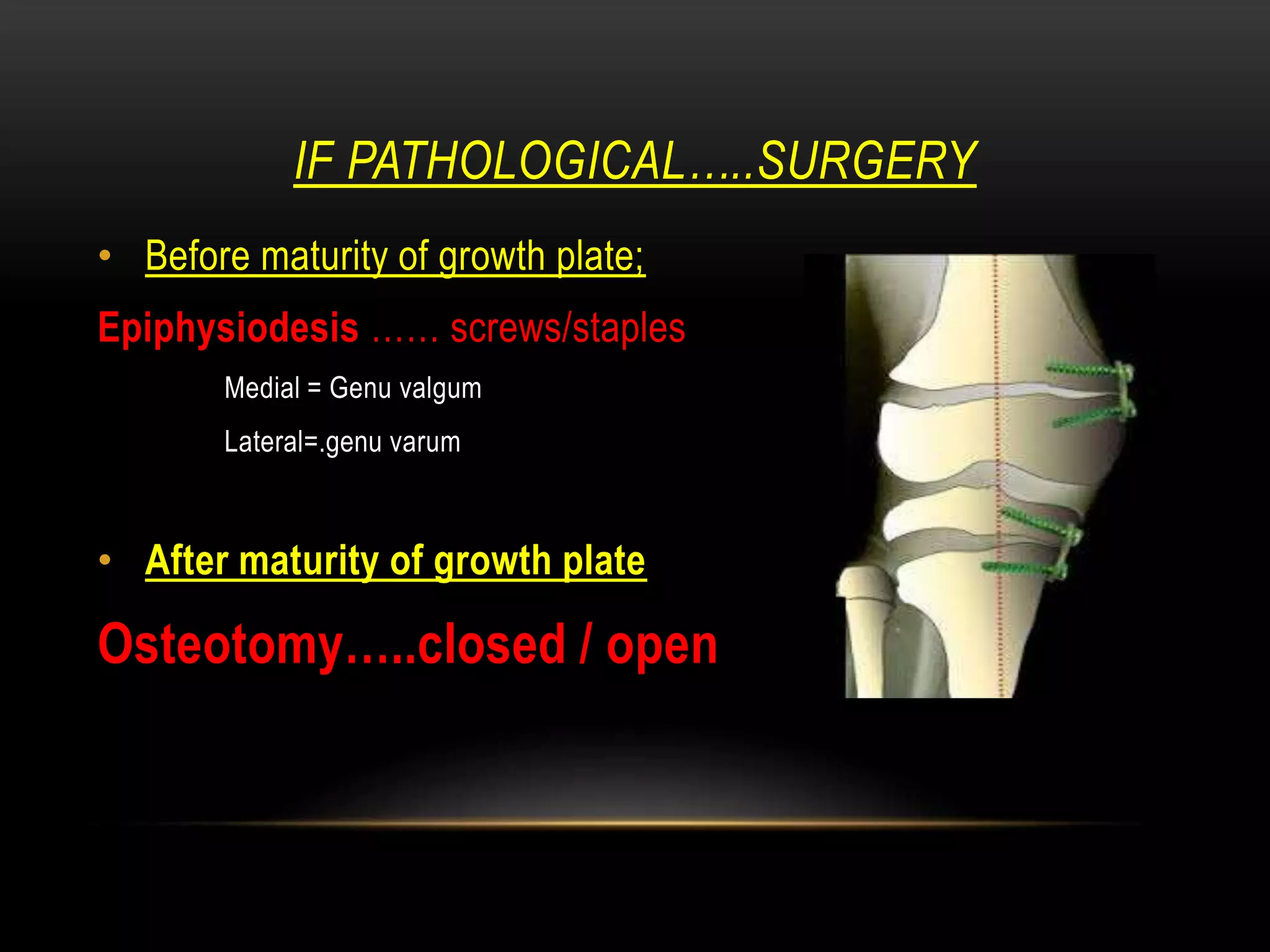 Genu varum valgus ,coxa varum | PPTX