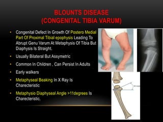 Genu varum valgus ,coxa varum | PPTX