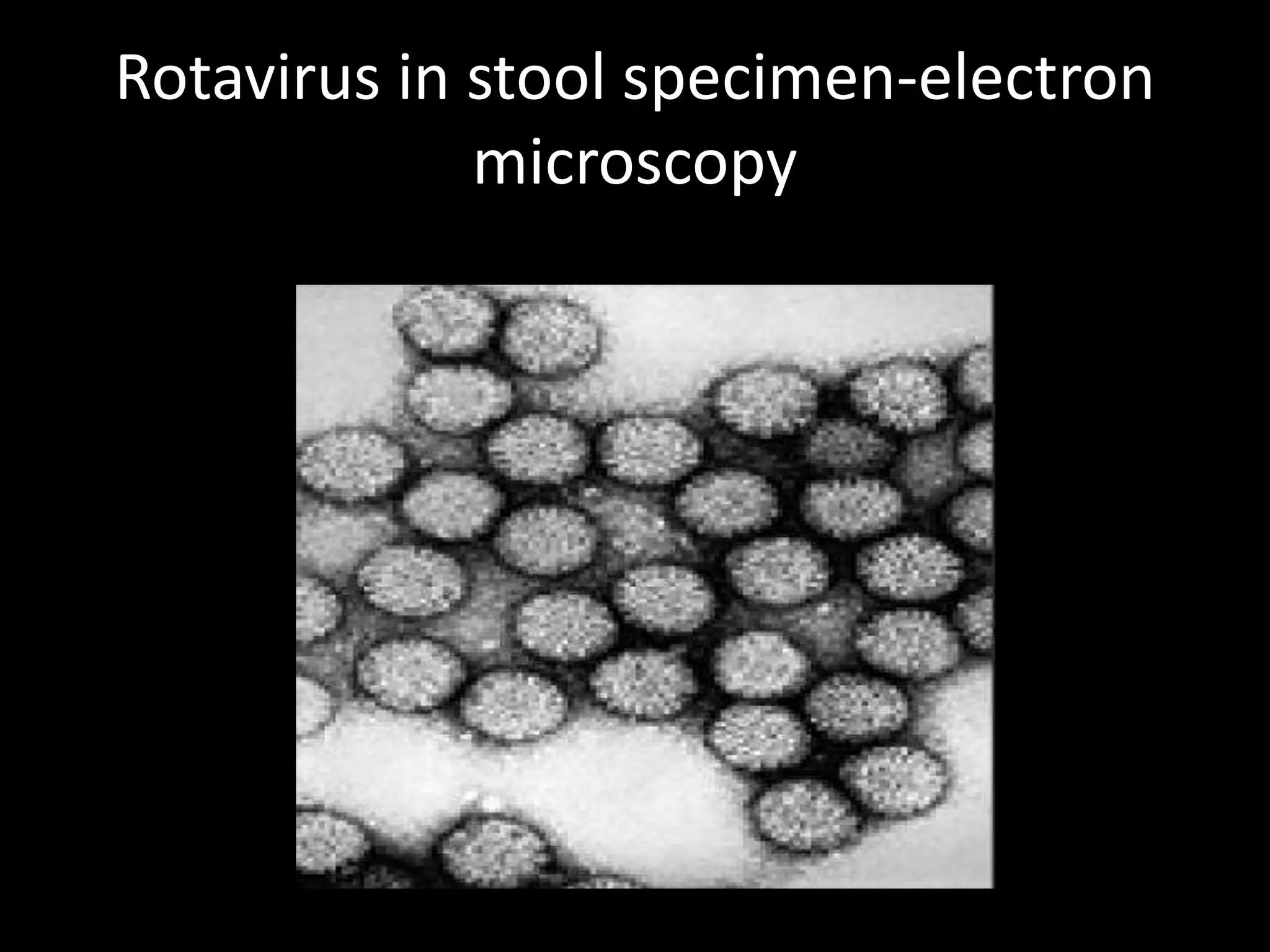 General virology 4 - Laboratory diagnosis, by Dr. Himanshu Khatri ...