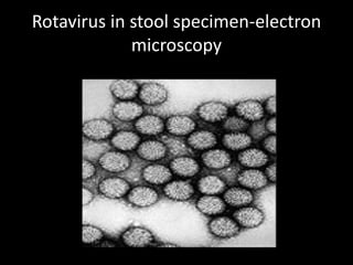 General virology 4 - Laboratory diagnosis, by Dr. Himanshu Khatri | PPTX