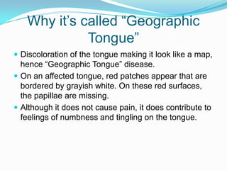 Geographic tongue disease powerpoint | PPTX