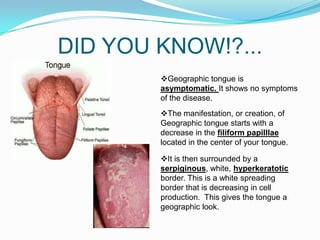 Geographic tongue disease powerpoint | PPTX