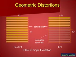 Geometric distortion artifact remedy | PPT