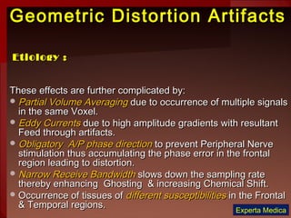 Geometric distortion artifact remedy | PPT