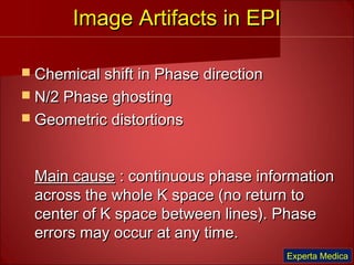 Geometric distortion artifact remedy | PPT