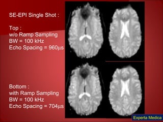 Geometric distortion artifact remedy | PPT