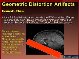 Geometric distortion artifact remedy | PPT