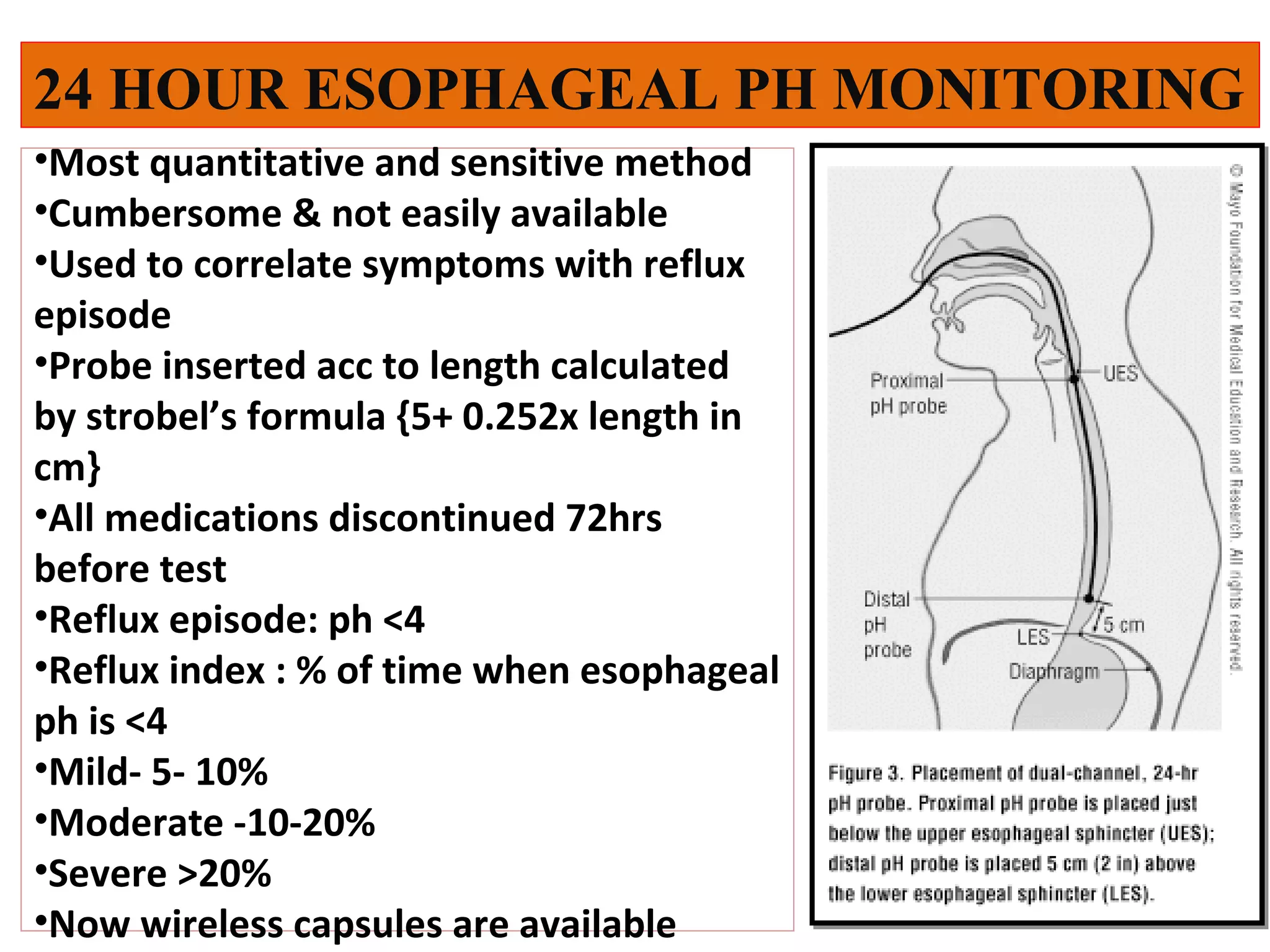 GERD IN CHILDREN | PPT