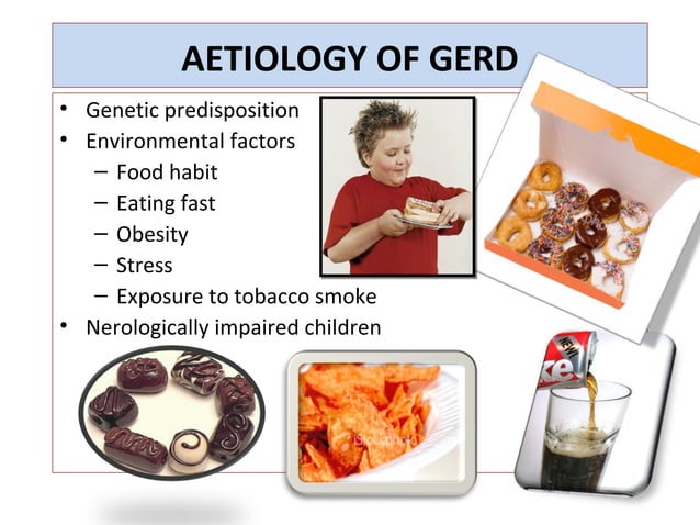 GERD IN CHILDREN | PPT