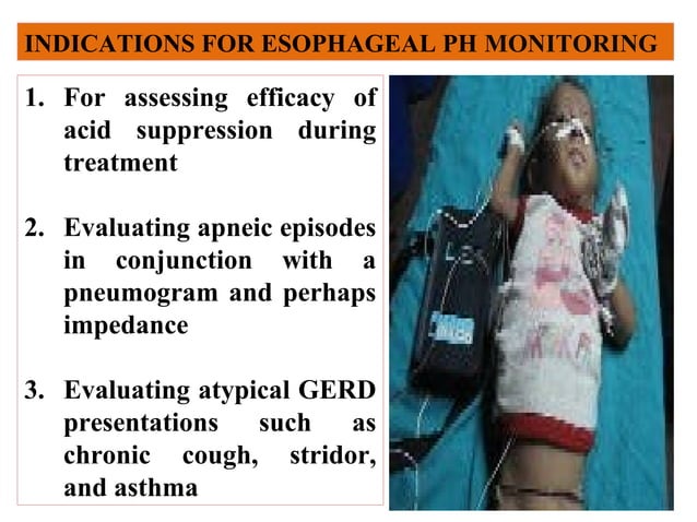 GERD IN CHILDREN | PPT