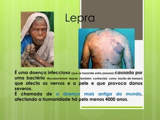 A Lepra e a ajuda aos Leprosos | PPT