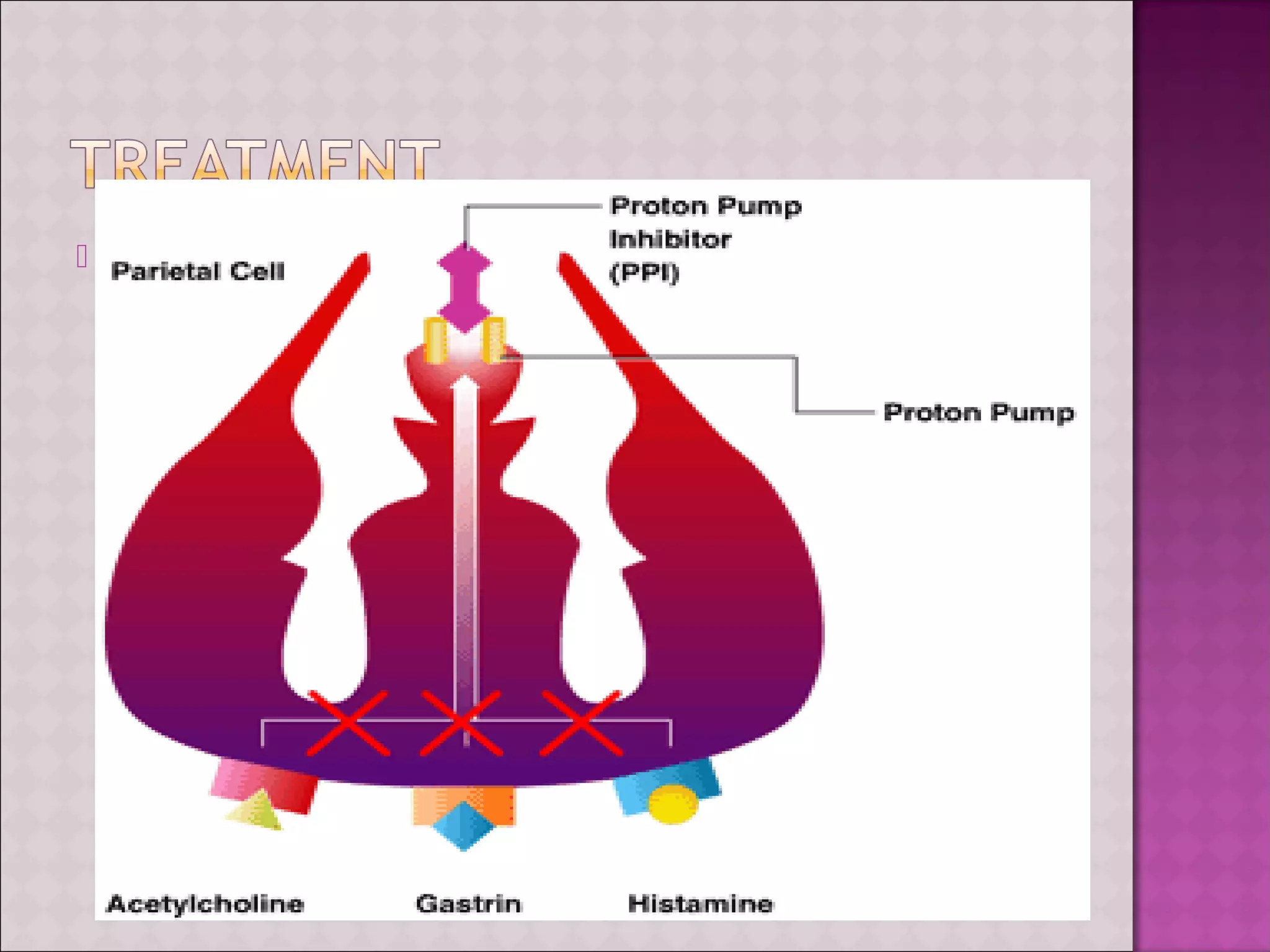 GASTROESOPHAGEAL REFLUX DISEASE | PPT