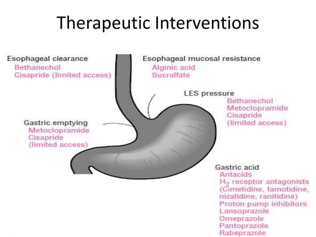 GERD - Overview for Pharmacy & Medical Students | PPTX | Digestive ...