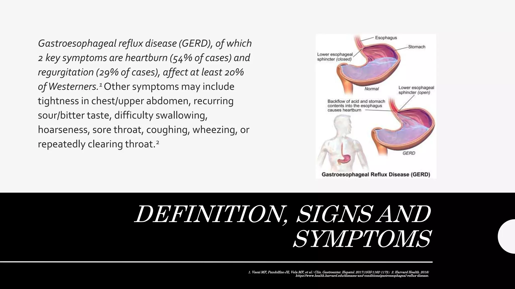 Gastroesophageal disease (GERD) in Adults | PPTX
