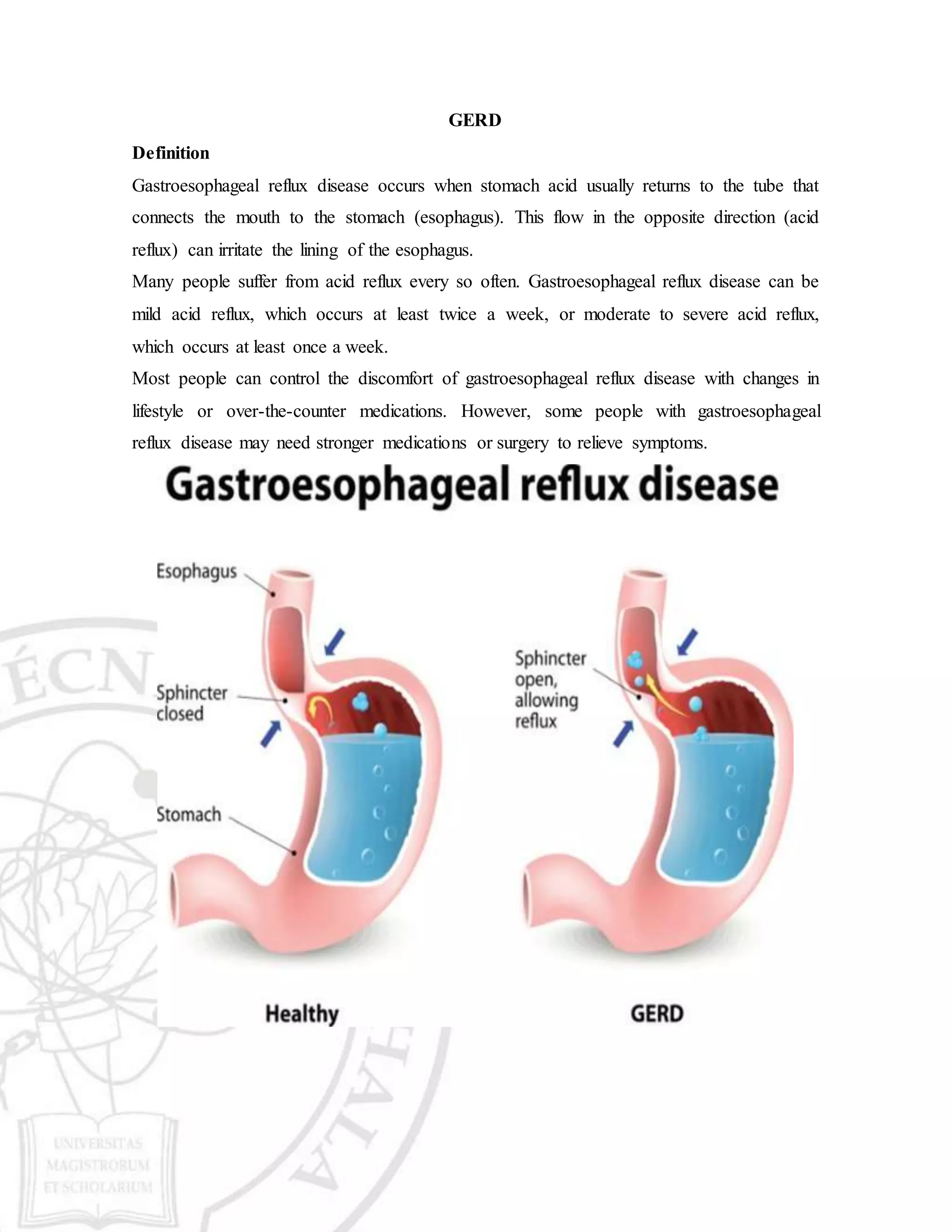 Gerd | PDF