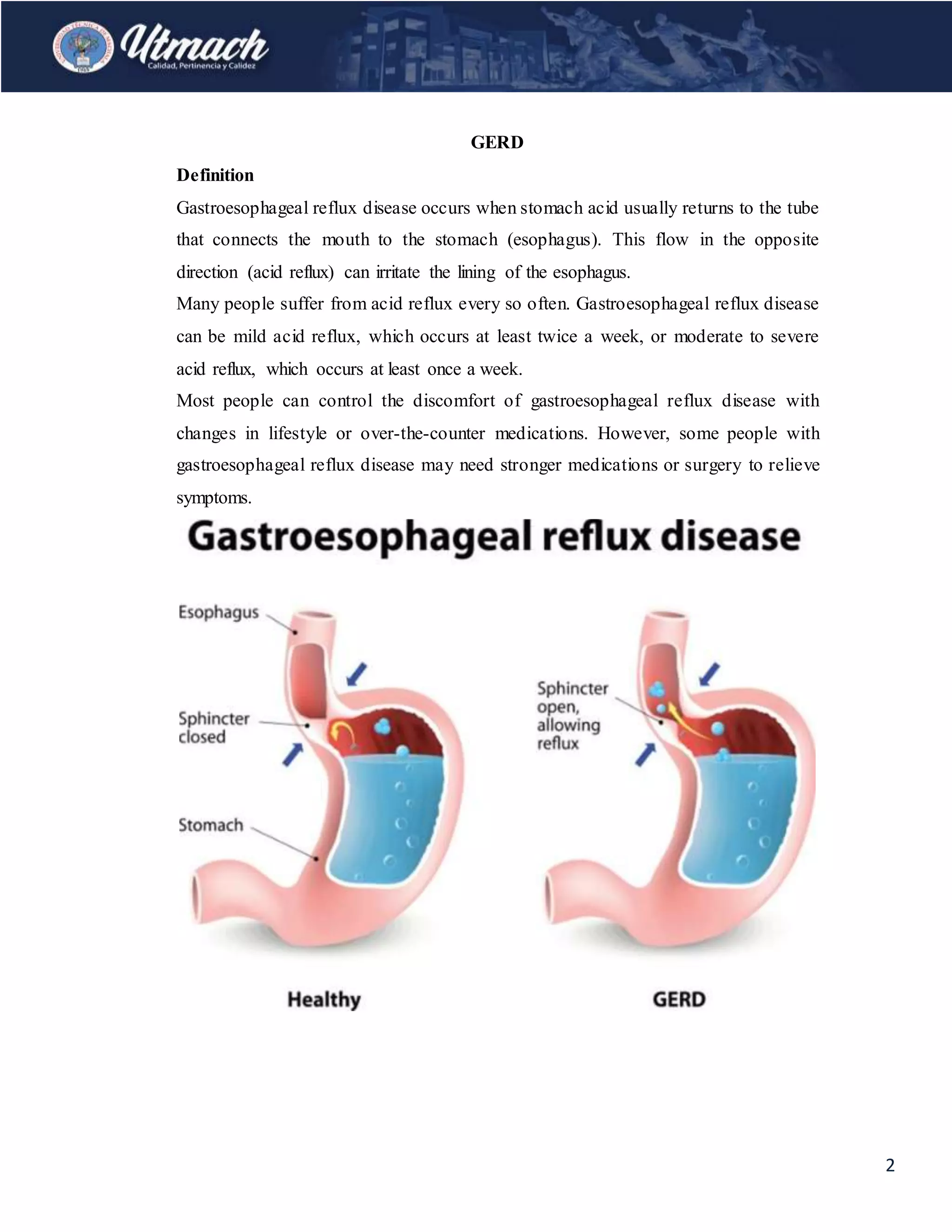 Gerd | PDF