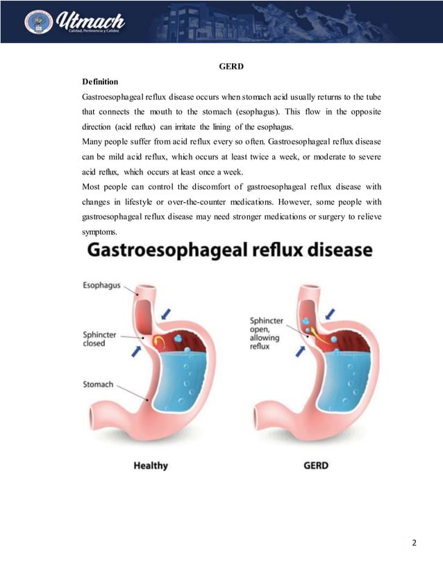 Gerd | PDF