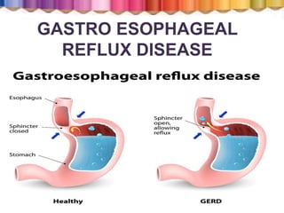 GASTRO ESOPHAGEAL REFLUX DISEASE | PPTX