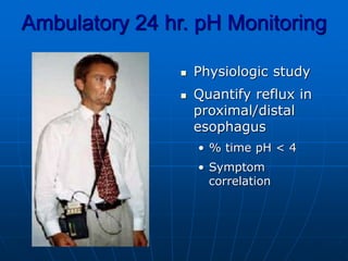 Gastro Esophageal Reflux Disease | PPT | Digestive Disorders | Diseases ...