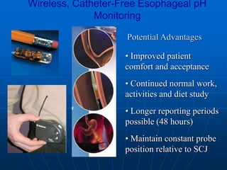 Gastro Esophageal Reflux Disease | PPT