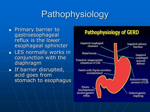 Gastro Esophageal Reflux Disease | PPT | Digestive Disorders | Diseases ...