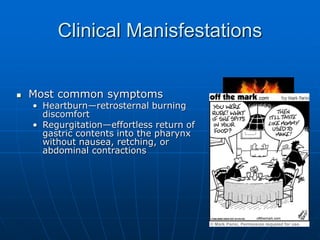 Gastro Esophageal Reflux Disease | PPT