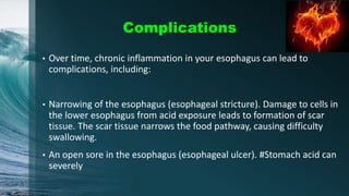 GERD | Gastro esophageal reflux disease-a brief medical study | PPTX