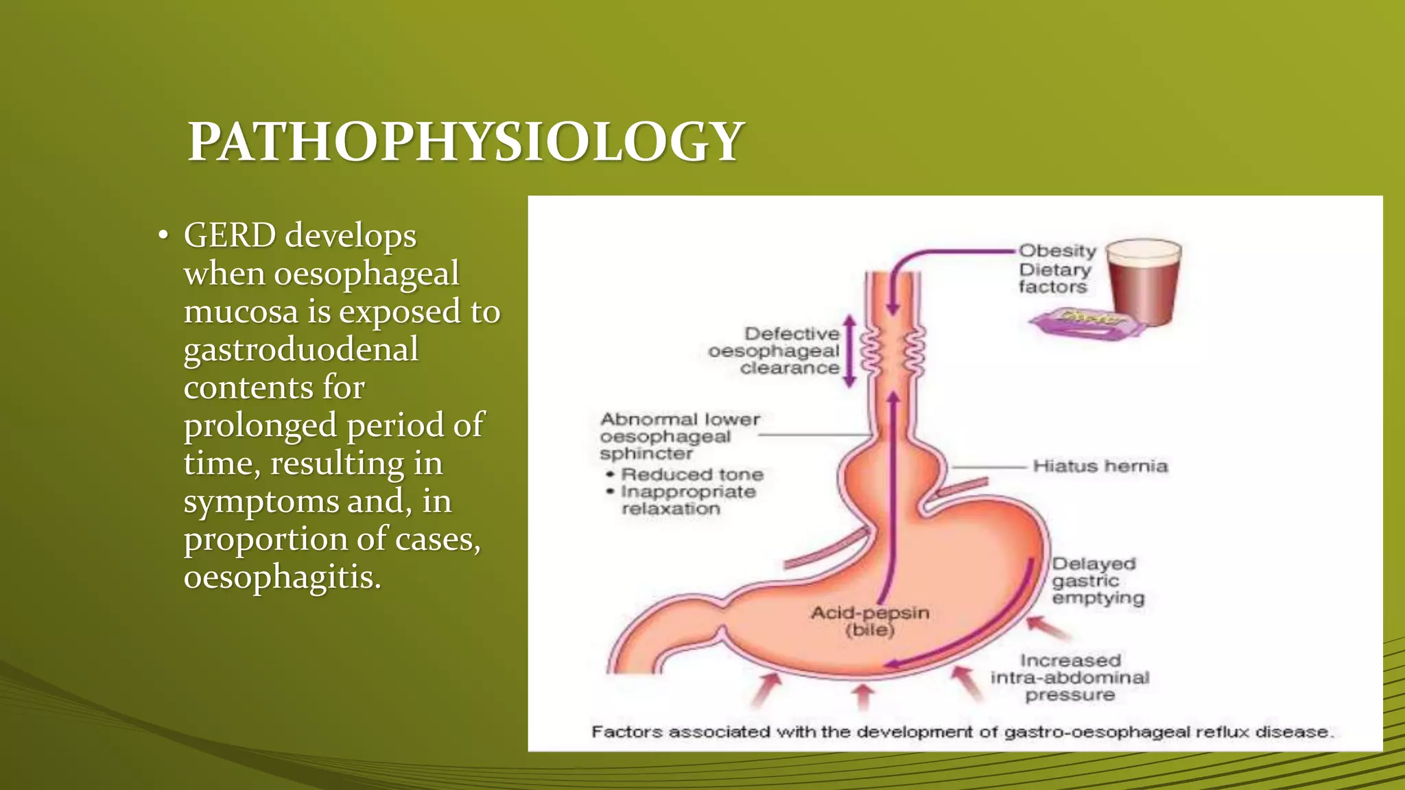 Gastroesophageal Reflux Disease (GERD) | PPTX