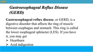 Gerd | PPT