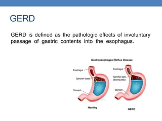 GERD.pptx