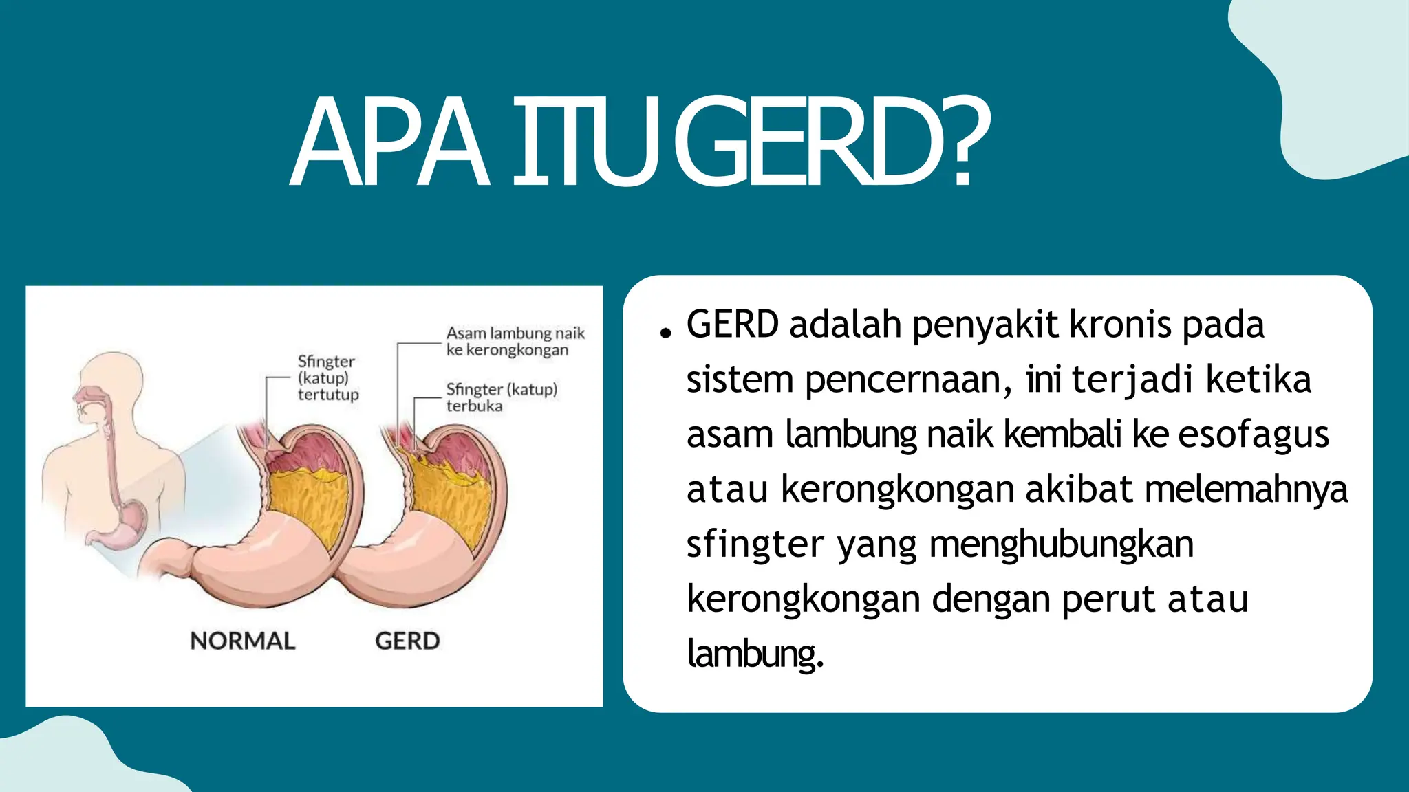 gerd.pptx