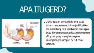 gerd.pptx