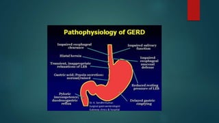 Gastroesophageal reflux disease presenta | PPTX