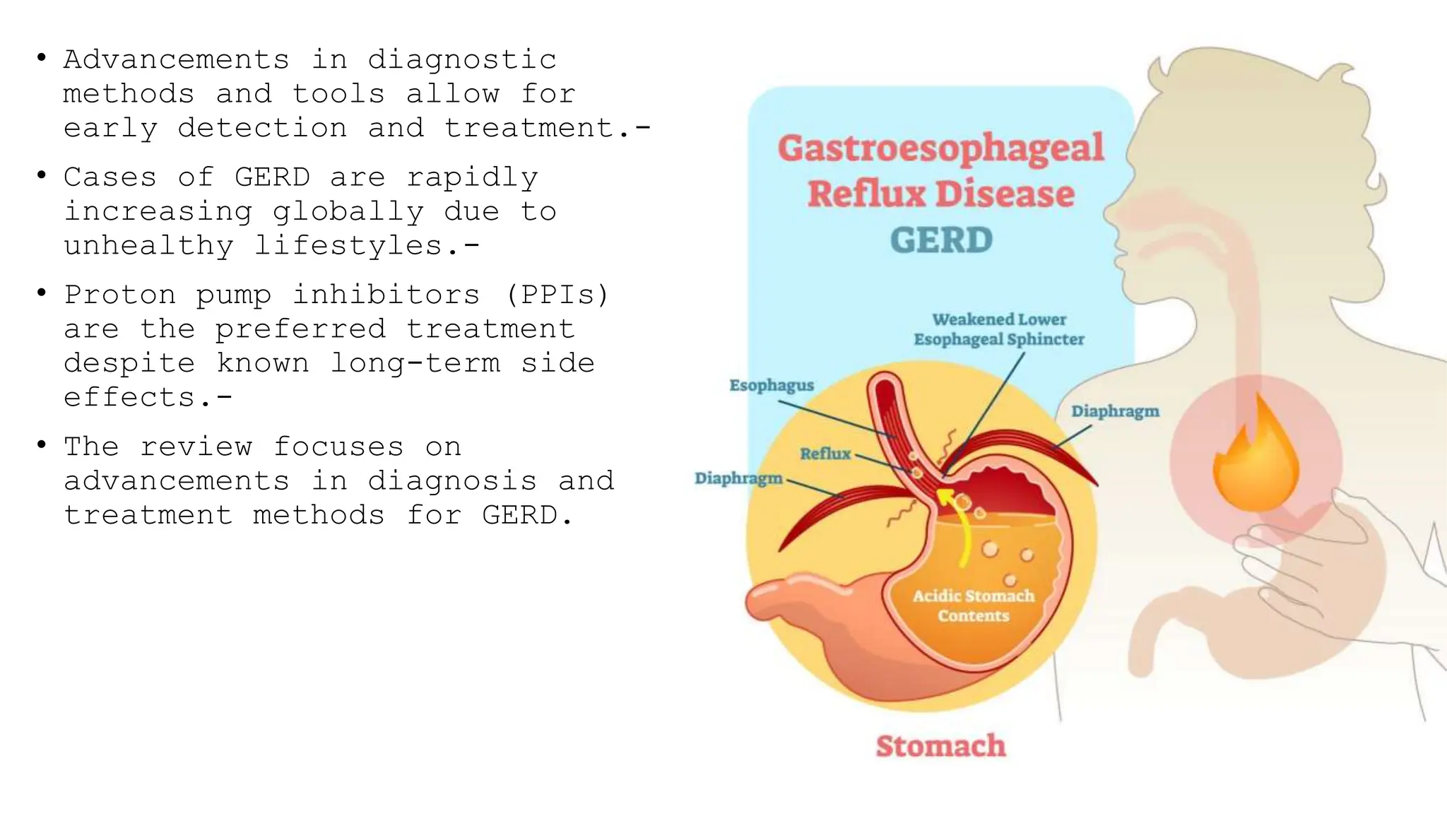 GERD gastro esophageal reflux disease.pptx