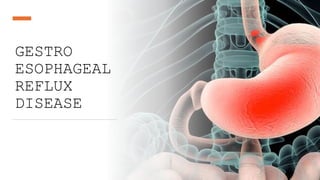 GERD gastro esophageal reflux disease.pptx