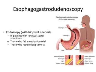 Gastro Esophageal Reflux Disease GER.pptx