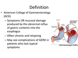Gastro Esophageal Reflux Disease GER.pptx