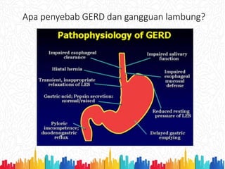 GERD gatroesofageal reflux disease (GERD) | PPT