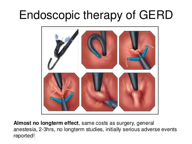 Gerd all in one 2011