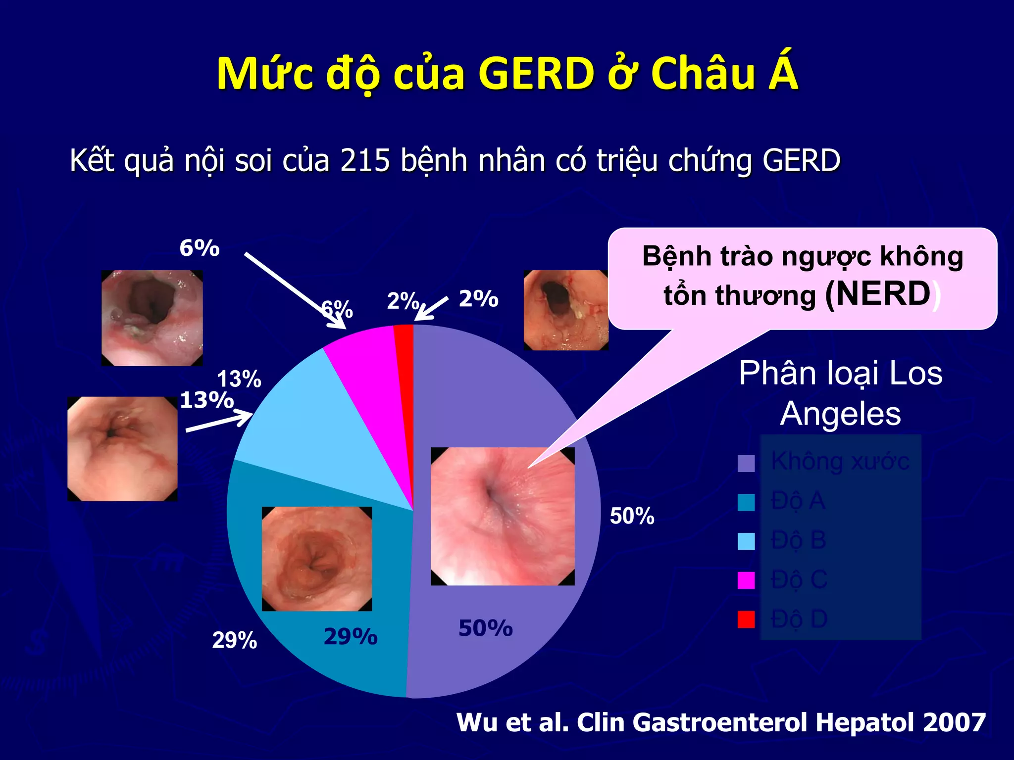 GERD - Dyspepsia Dong nai.pdf