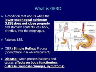 Gastro Esophageal Reflux Disease | PPT