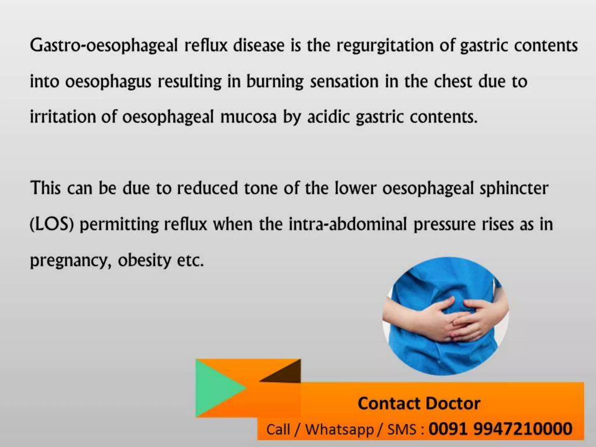 Everything you should know about GERD - Doctor Answers | PPTX