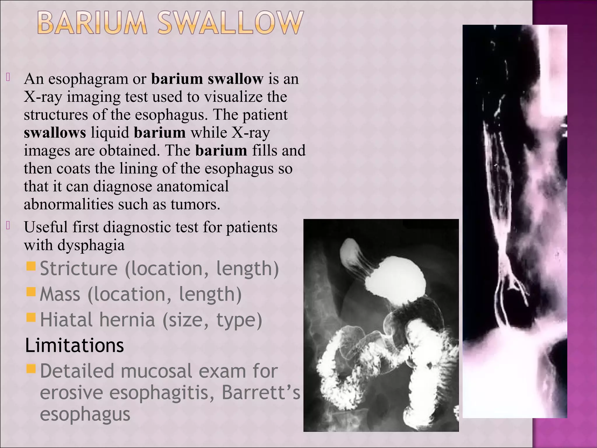 Gastro esophageal Reflux Disease (GERD) and its management | PPT