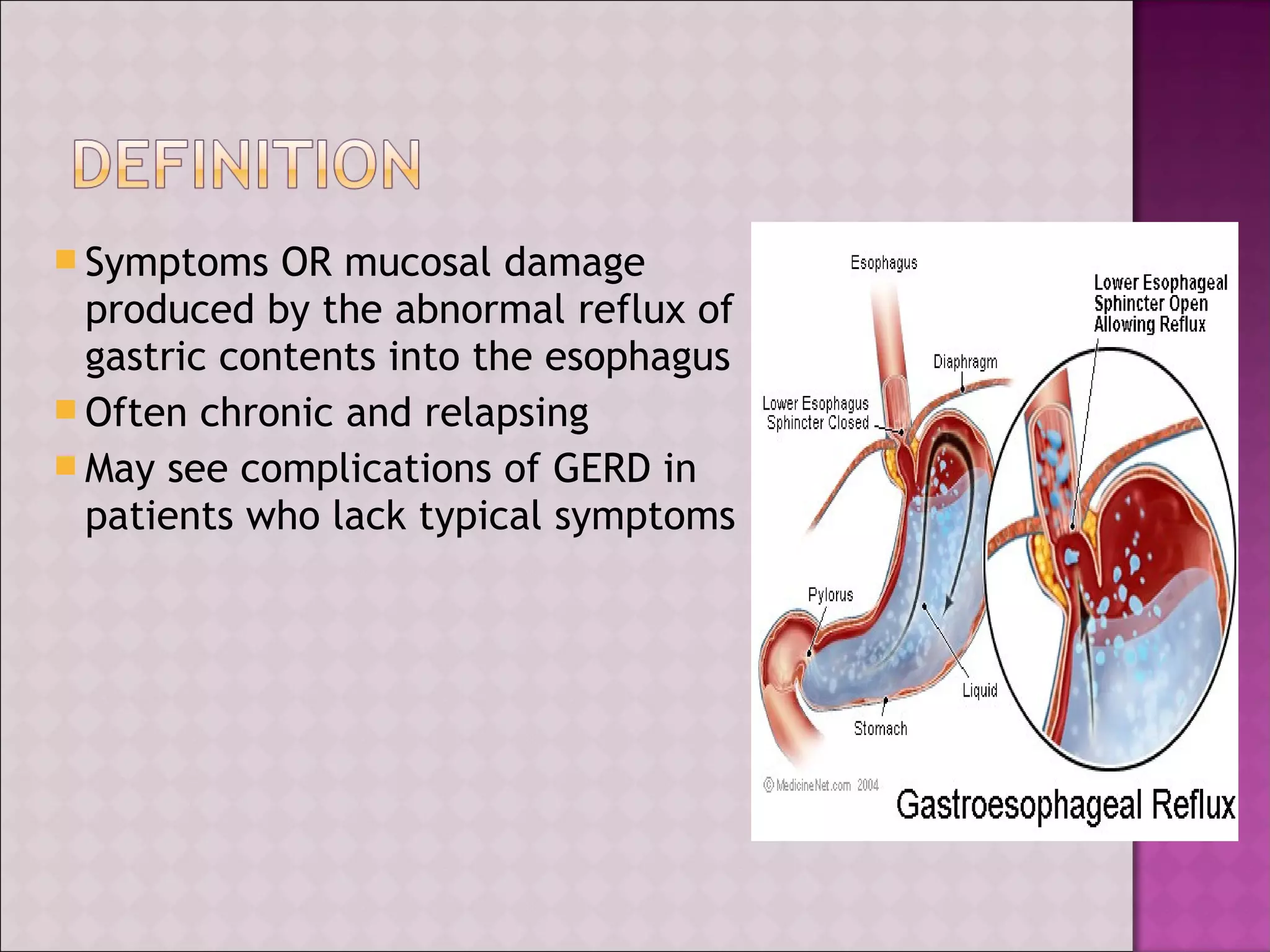 Gastro esophageal Reflux Disease (GERD) and its management | PPT