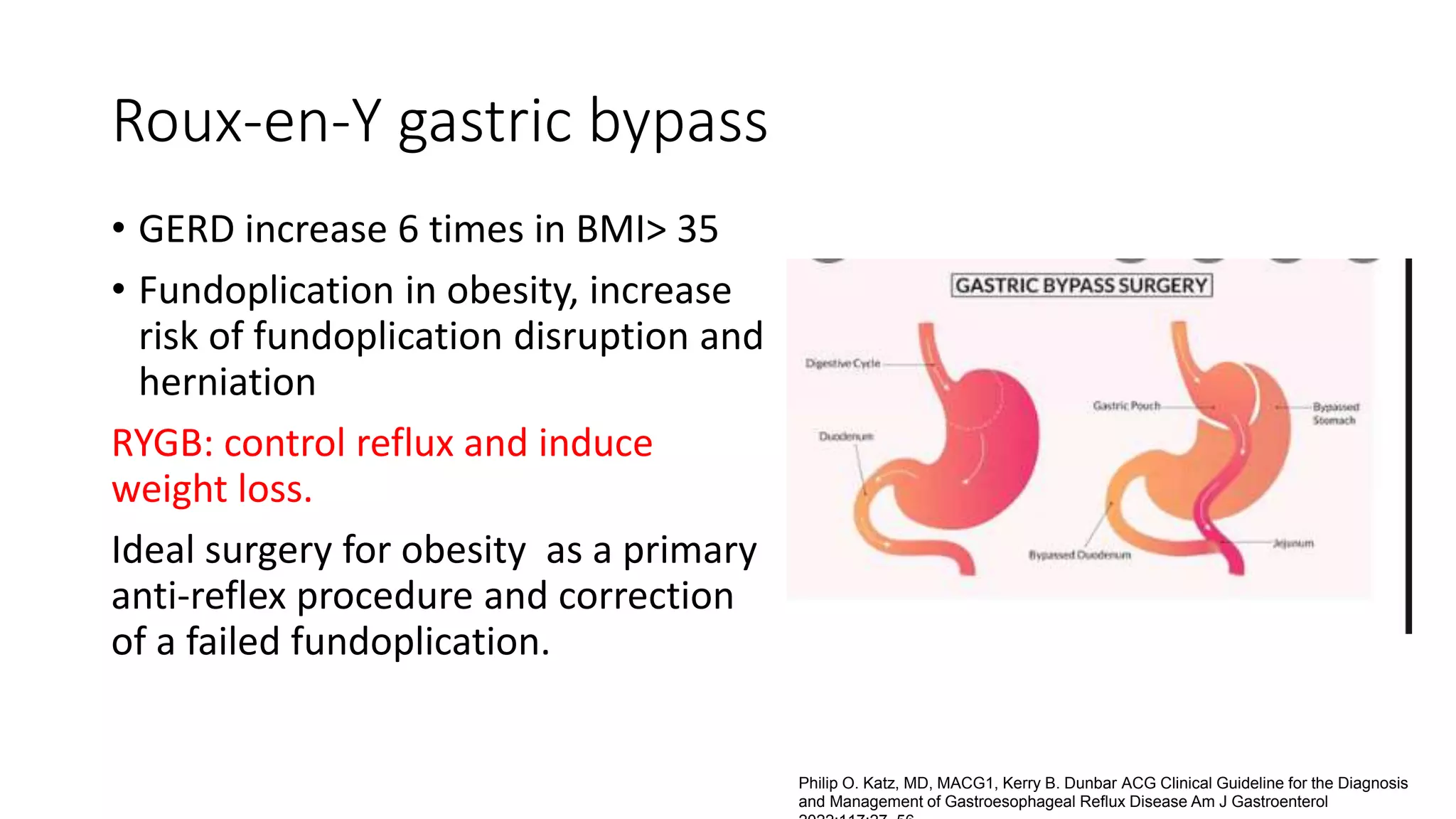 Management of GERD.pptx