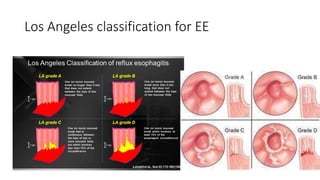 Management of GERD.pptx
